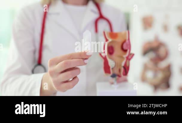Proctologist doctor holds rectal suppository and artificial model of ...