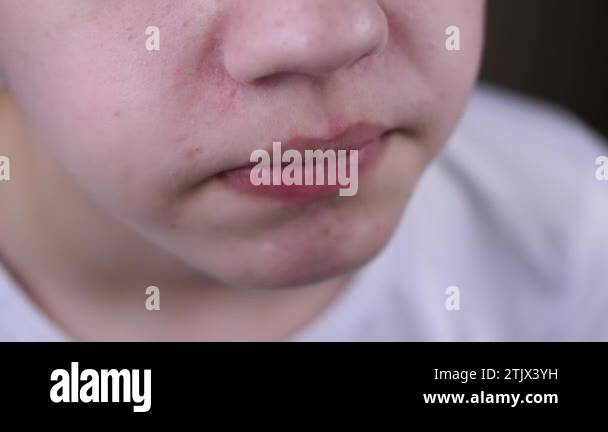 Close up, Child Chews Chewing Gum, then Stretch it Out of Mouth with ...