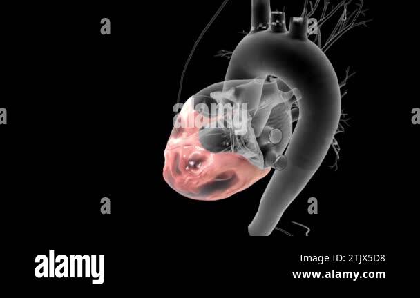 Cardiac Fat. There are 3 major fat depots around the heart: pericardial ...