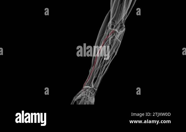 The radial artery provides blood supply to the elbow joint, lateral ...