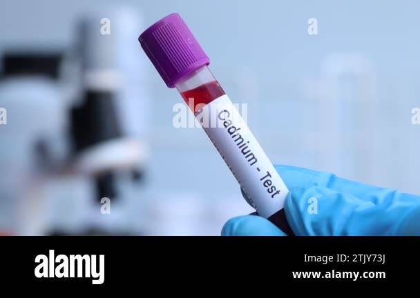 Cadmium test to look for abnormalities from blood, blood sample to ...