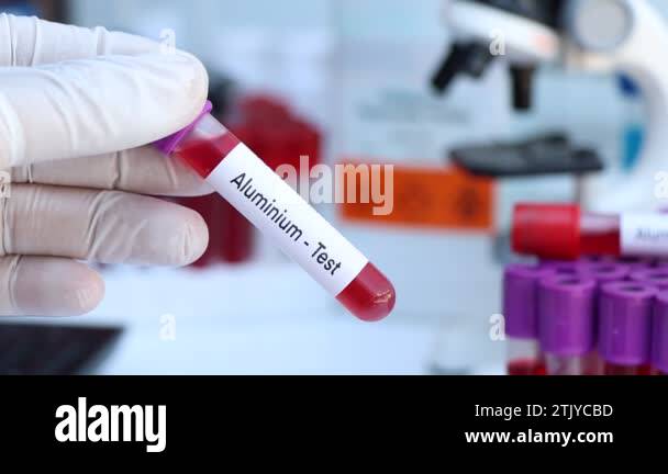 aluminium test to look for abnormalities from blood, blood sample to ...