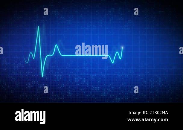 Animation electrocardiogram heartbeat. Display on monitor pulse line ...