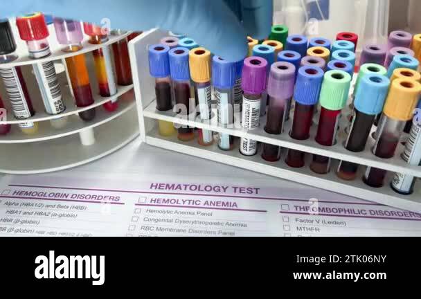 Technician lab with Blood testing over requisition report for ...
