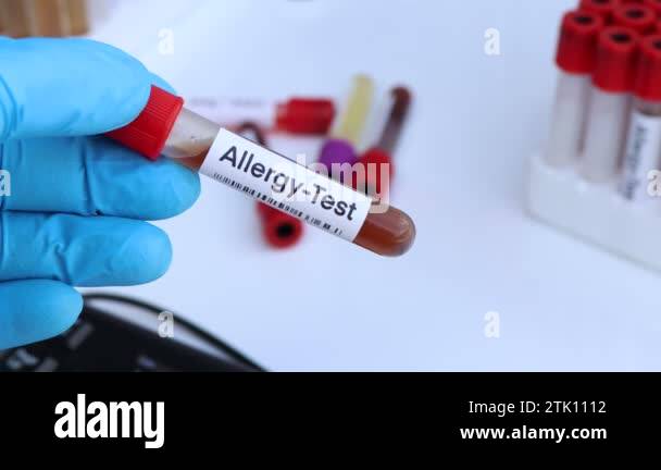 Allergy test to look for abnormalities from blood, blood sample to ...