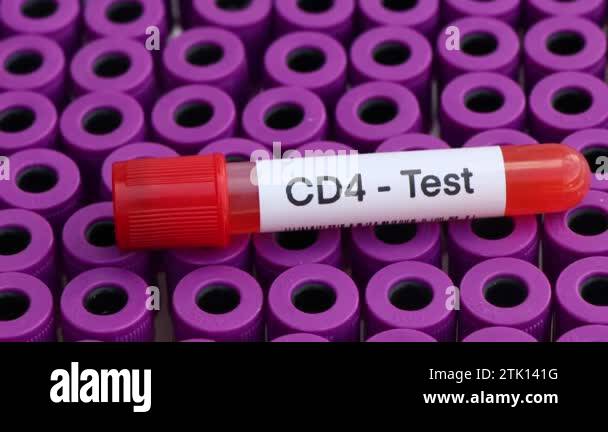 Cd4 Count Stock Videos And Footage Hd And 4k Video Clips Alamy