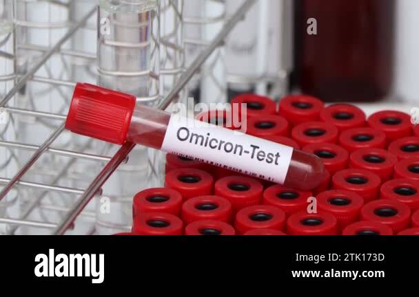Omicron test to look for abnormalities from blood, blood sample to ...
