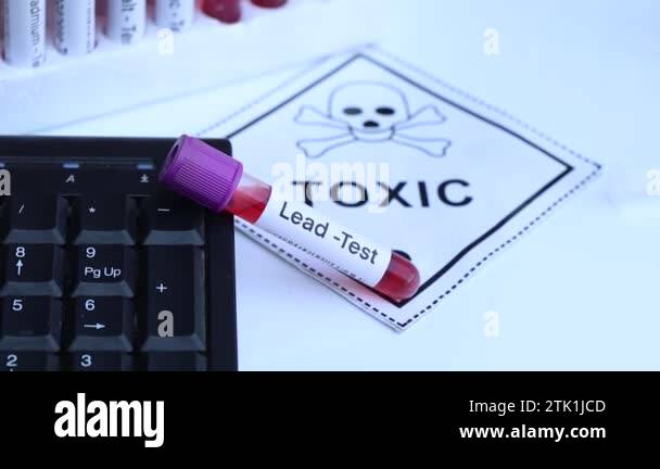 Lead test to look for abnormalities from blood, blood sample to analyze ...