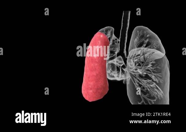 The middle temporal gyrus is located on the lateral surface of the ...