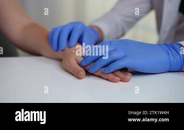 Close-up doctor hands in gloves examining monkeypox rash on female hand ...