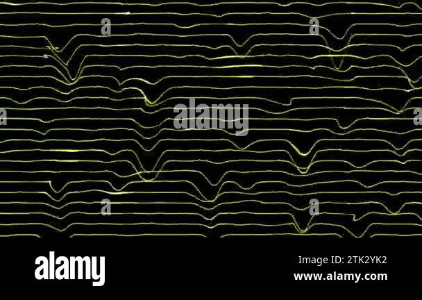 stage video background. Seamless loop motion graphics for nightclub ...