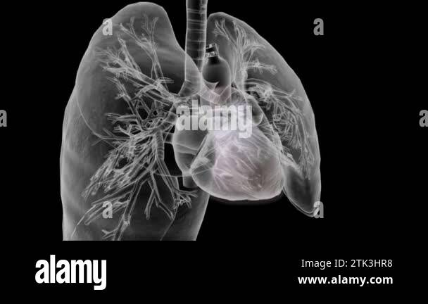 The pericardium is a fibrous sac that encloses the heart and great ...