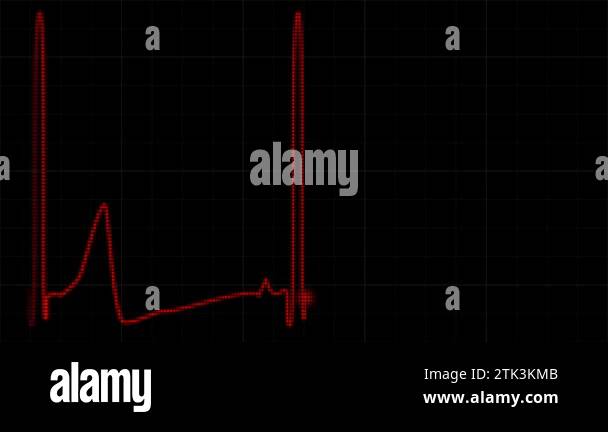 Heartbeat flatline. Seamlessly looping animation. Screen cells or ...