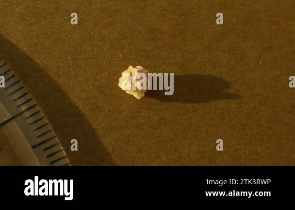 Macro shooting An oxalate stone from a human kidney close-up, measuring ...