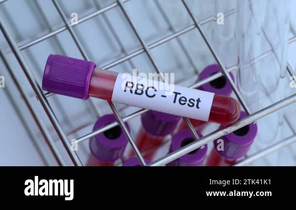 RBC test to look for abnormalities from blood, blood sample to analyze ...