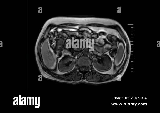 Human body scanning through CT scan Stock Video Footage - Alamy