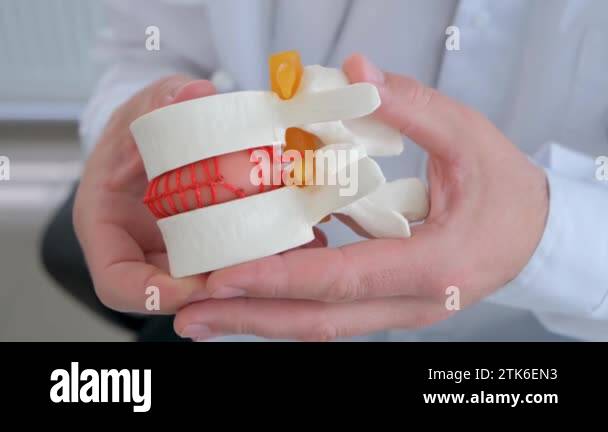 A close-up of the plastic model of the back part of the vertebra. The ...