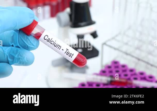 Calcium blood test Stock Videos & Footage - HD and 4K Video Clips - Alamy