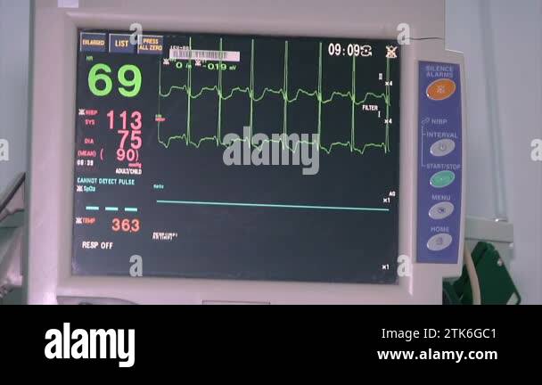 Ekg Heart Monitor ; Medical EKG Heart Rate Monitor at Hospital Stock ...