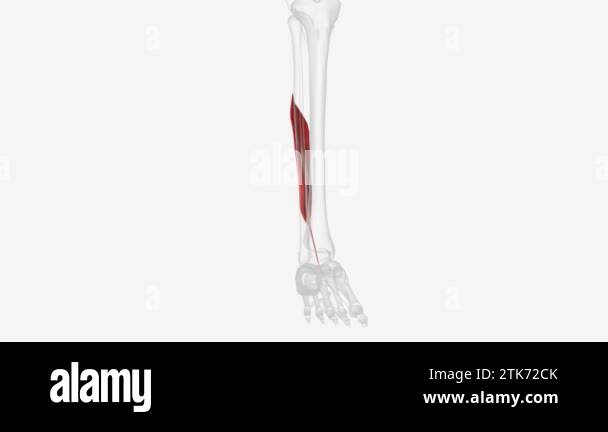Flexor hallucis longus (FHL) is a powerful muscle located on the ...