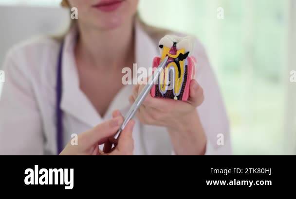 Dentist showing model of artificial tooth in examination room. Doctor ...