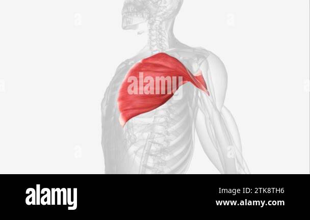 A pectoralis major strain refers to a tear in the large muscle which ...