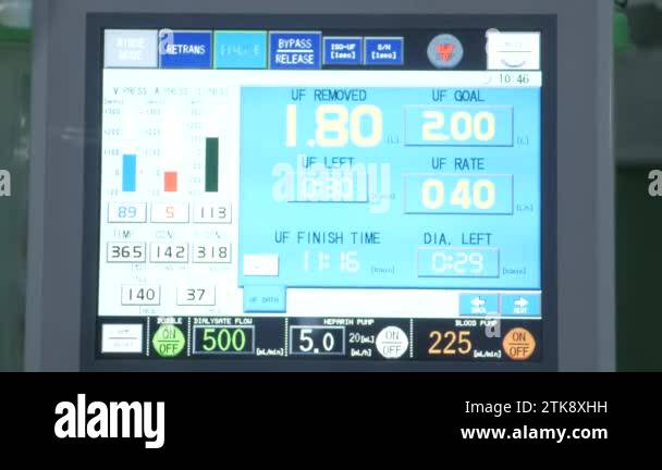 Monitor kidney dialysis machine Stock Videos & Footage - HD and 4K ...