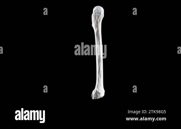 Right human femur bone, posterior view, bone anatomy, black background ...