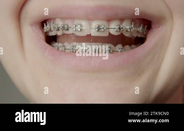 Young teeth Stock Videos & Footage - HD and 4K Video Clips - Alamy