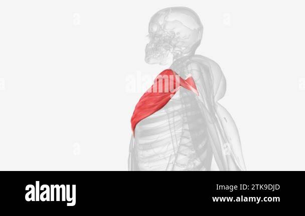 A pectoralis major strain refers to a tear in the large muscle which ...