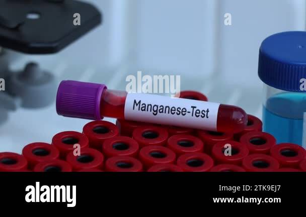 Manganese to look for abnormalities from blood, blood sample to analyze ...