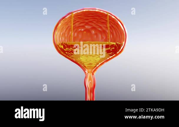 urine color, Light yellow to red urine color, detailed urinary bladder ...