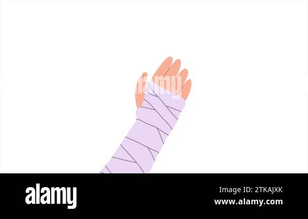 Broken arm. Gypsum bandage. Waving hand gesture. Medical care ...