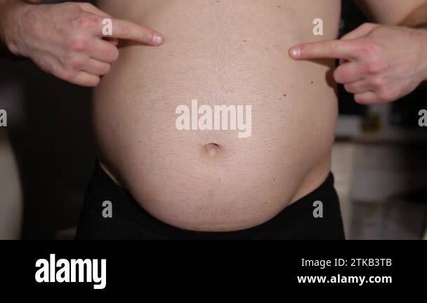 An overweight man demonstrates a big belly. Abdomen overgrown with fat ...