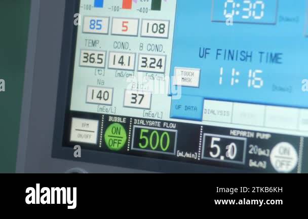 malang, indonesia -27 august 2023 : monitor screen of a dialysis ...