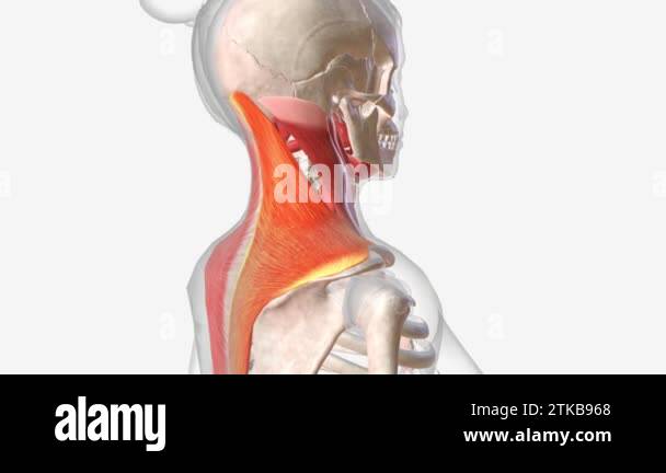 Trapezius myalgia (TM) is the complaint of pain, stiffness, and ...