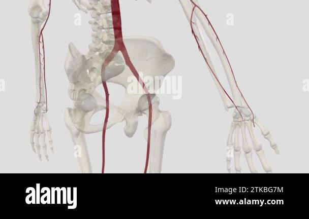 The ulnar artery terminates at the hand via its branches the palmar ...
