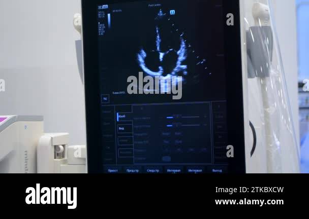 Utrasound image on the monitor close-up. Ultrasound Scan display ...
