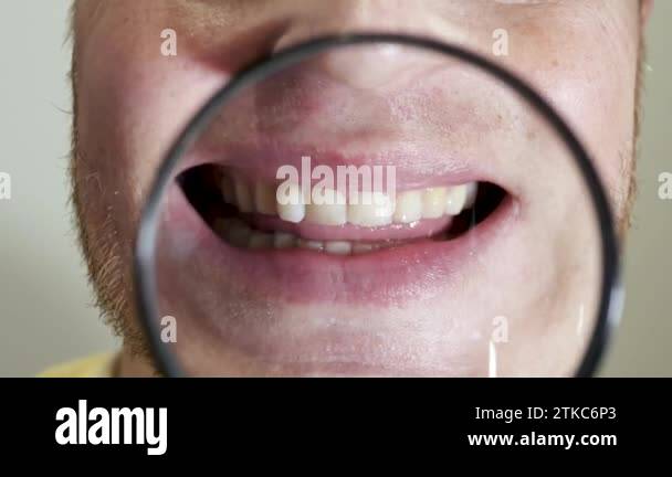 A young man demonstrates beautiful white teeth through a magnifying ...