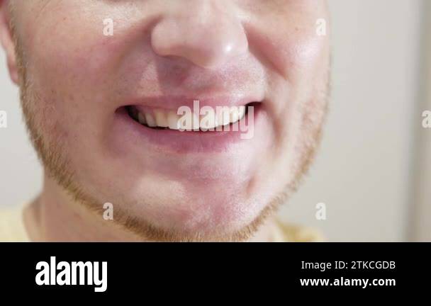 The man laughs happily. Incredibly cute male smile close-up. The man ...