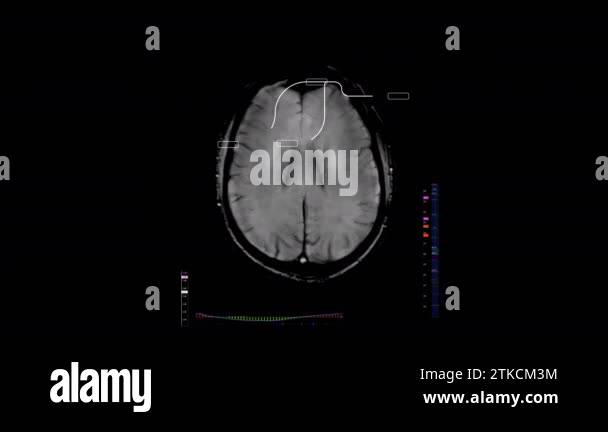 Brain MRI scans and diagnostic hi-tech data screenComputer screen with ...