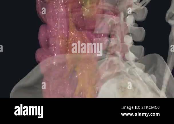 The ascending colon lies on the right side of the abdominal cavity, in ...