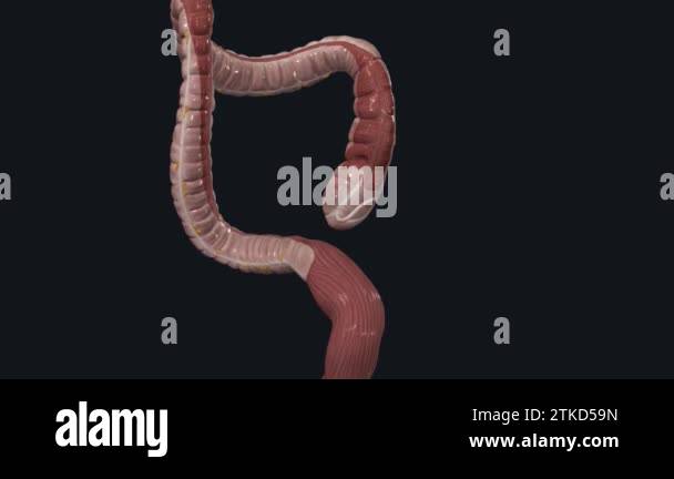 The colon, which forms most of the large intestine, is a tube of ...