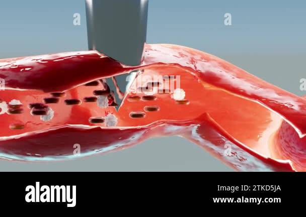 Hemostasis. Red blood cells and platelets in the blood vessel. Basic ...