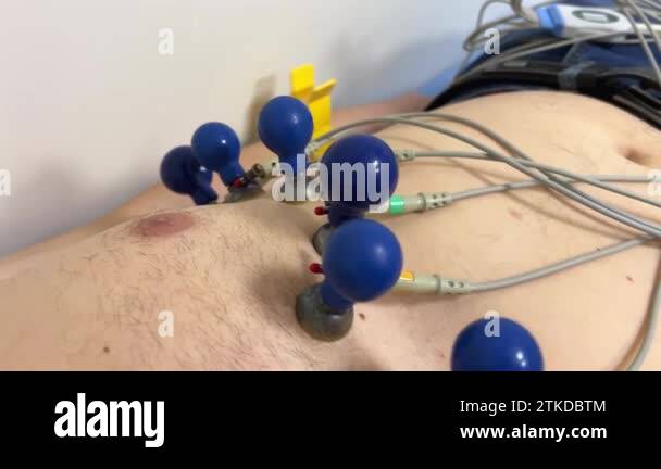 diagnoses heart disease cardiogram ECG or EKG of heart with electrodes ...