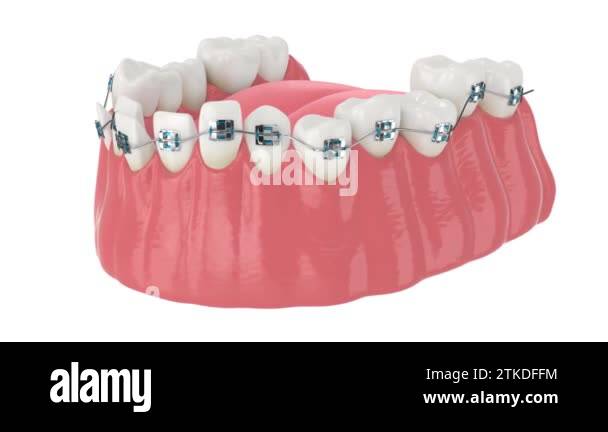 Dent defect Stock Videos & Footage - HD and 4K Video Clips - Alamy