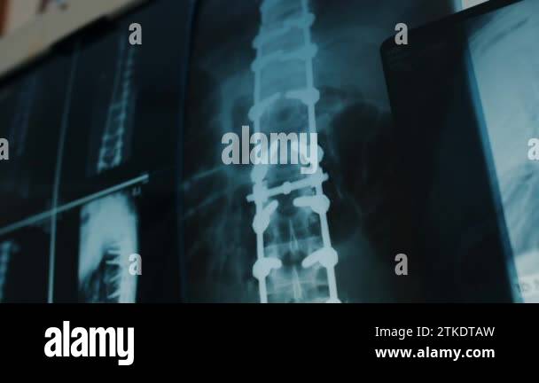 Roentgen mri Stock Videos & Footage - HD and 4K Video Clips - Alamy