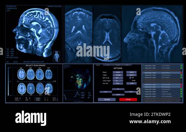MRI brain scanning animation. Neurology data, vital signs on display ...