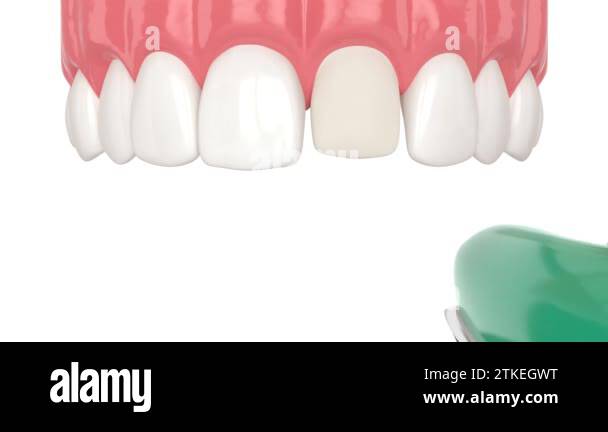 Aesthetic placement Stock Videos & Footage - HD and 4K Video Clips - Alamy