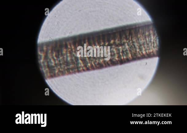 Human hair under a microscope. Microscopy of a single human hair from ...